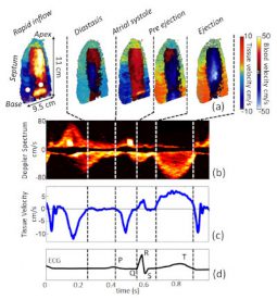 Clément Papadacci awarded at EuroEcho conference | Physics for Medicine ...