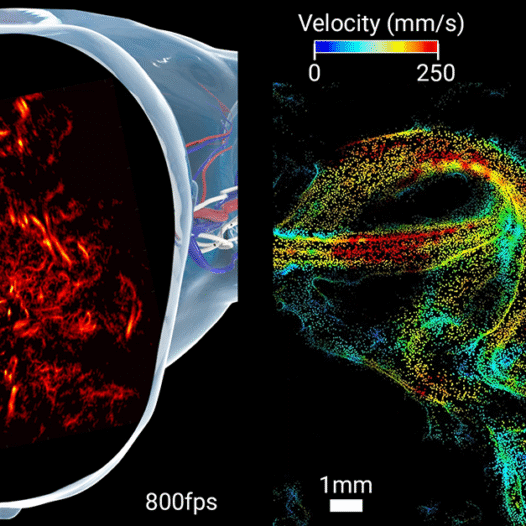 Imaging the brain through the skull: a comprehensive review | Physics ...